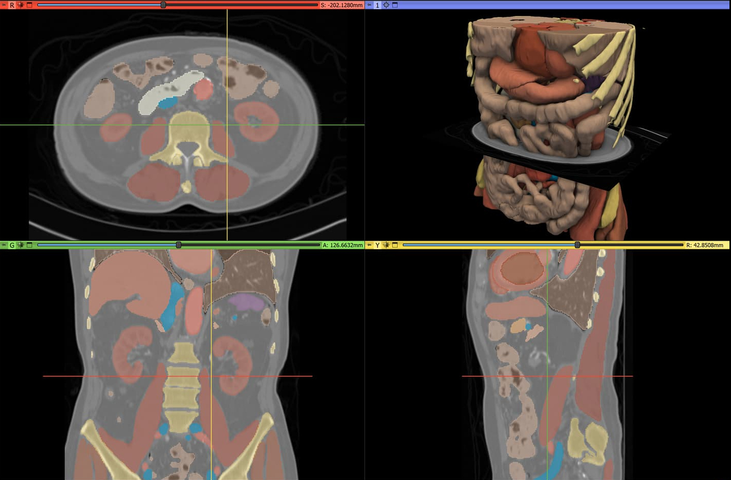 Batch Conversion Of 3d Data To Dicom Seg Using 3d Slicer 3407